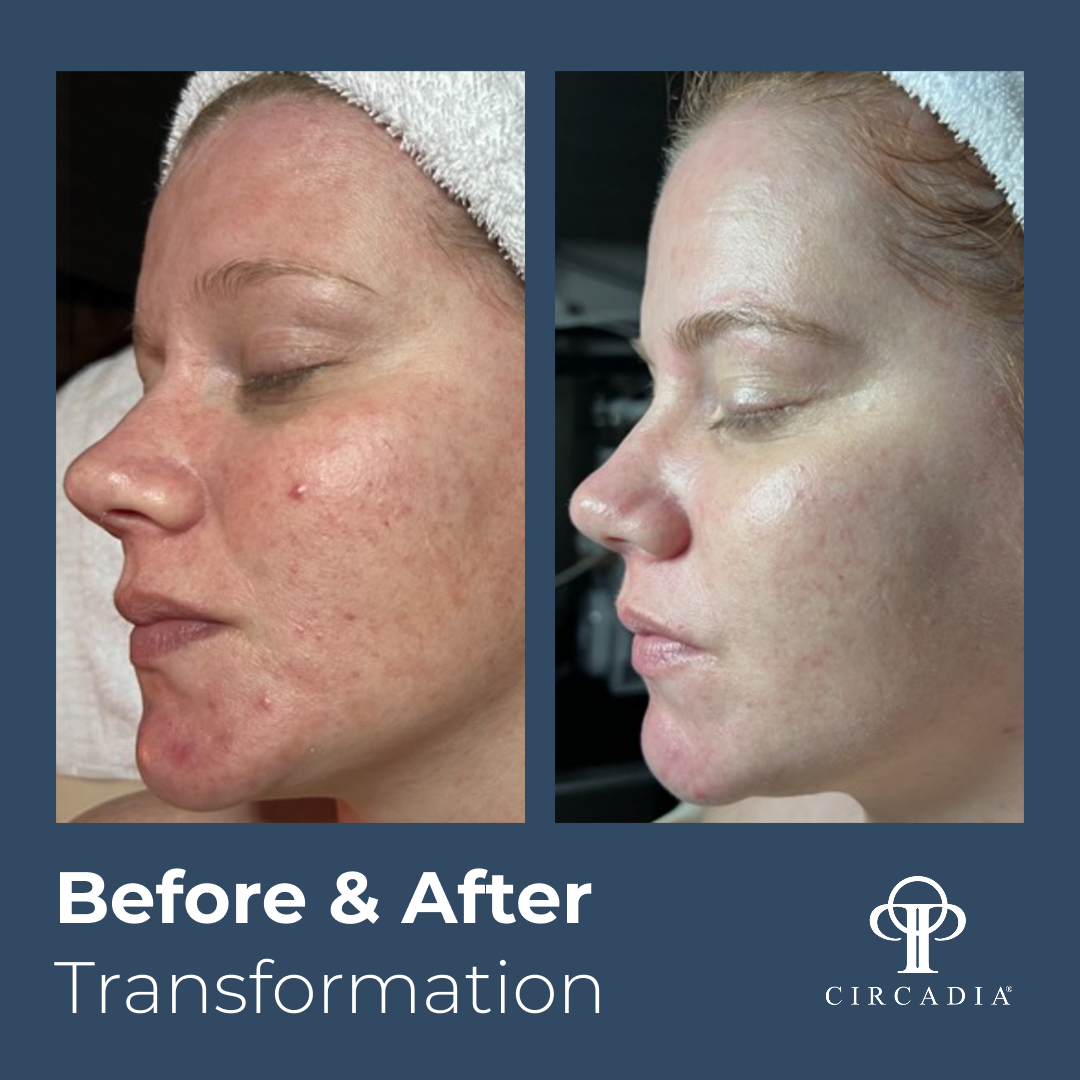 Calming Facial Complete Bundle | Circadia-Samena.com